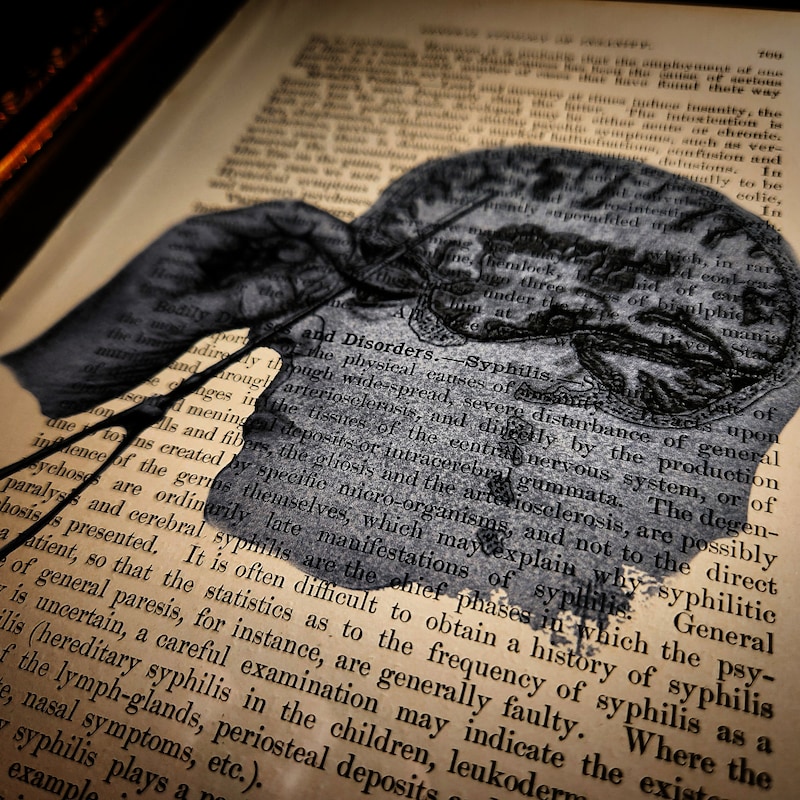 Lobotomy Kit - Etsy