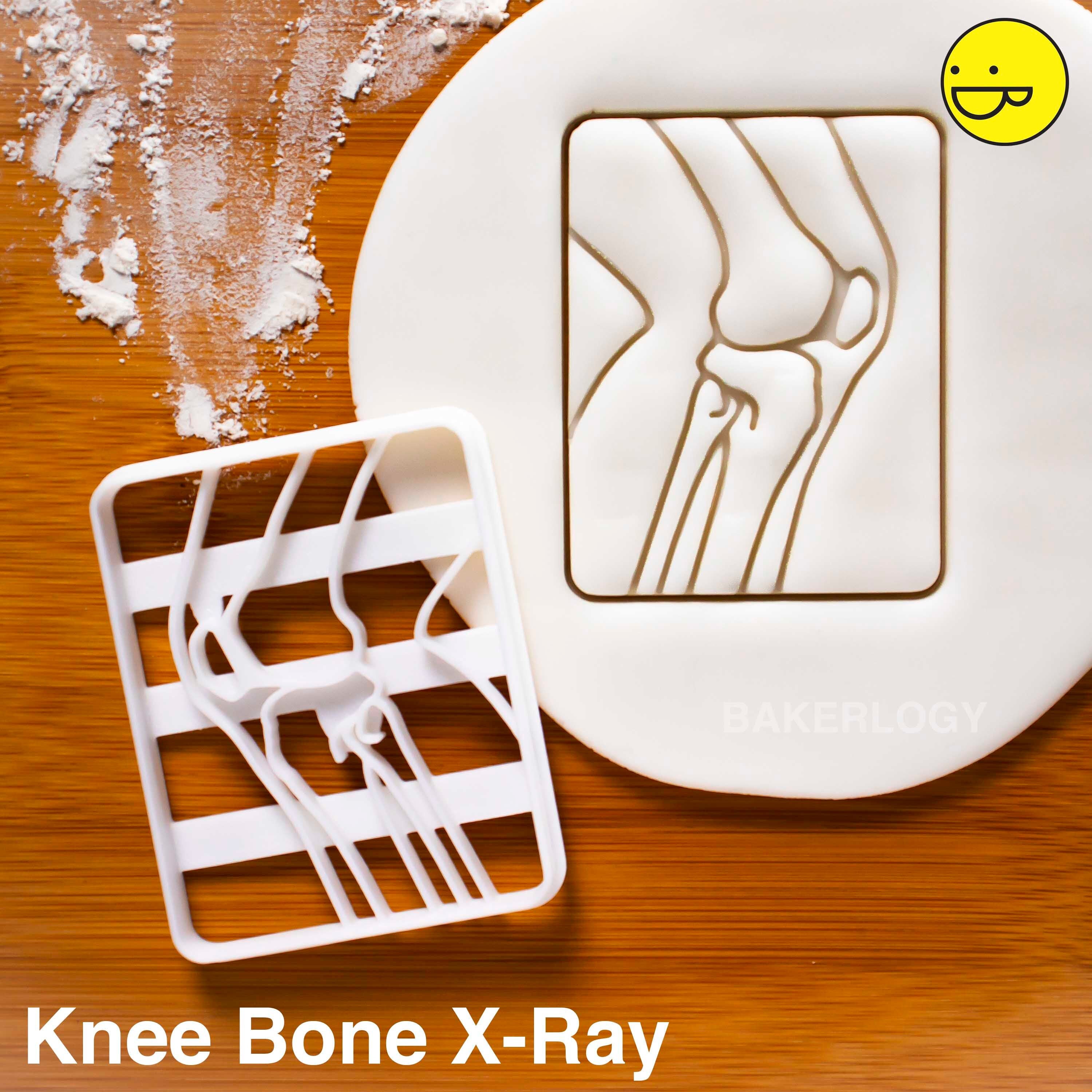 X-ray Knee Bone Cookie Cutter Biscuit Cutters Gifts - Etsy UK