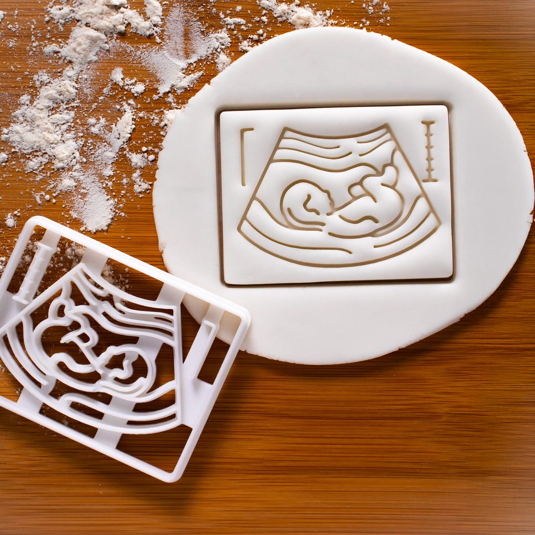 Pregnancy Ultrasound Cookie Cutter – Baby Scan Shape for Gender Reveal ...