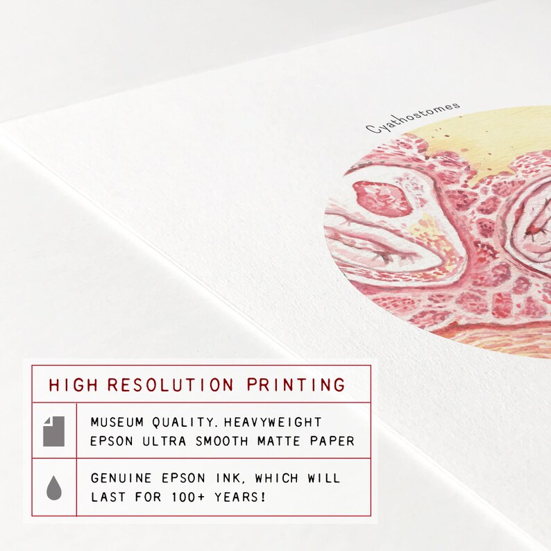 Cyathostomes Science Art Print Horse Parasite Poster | Etsy