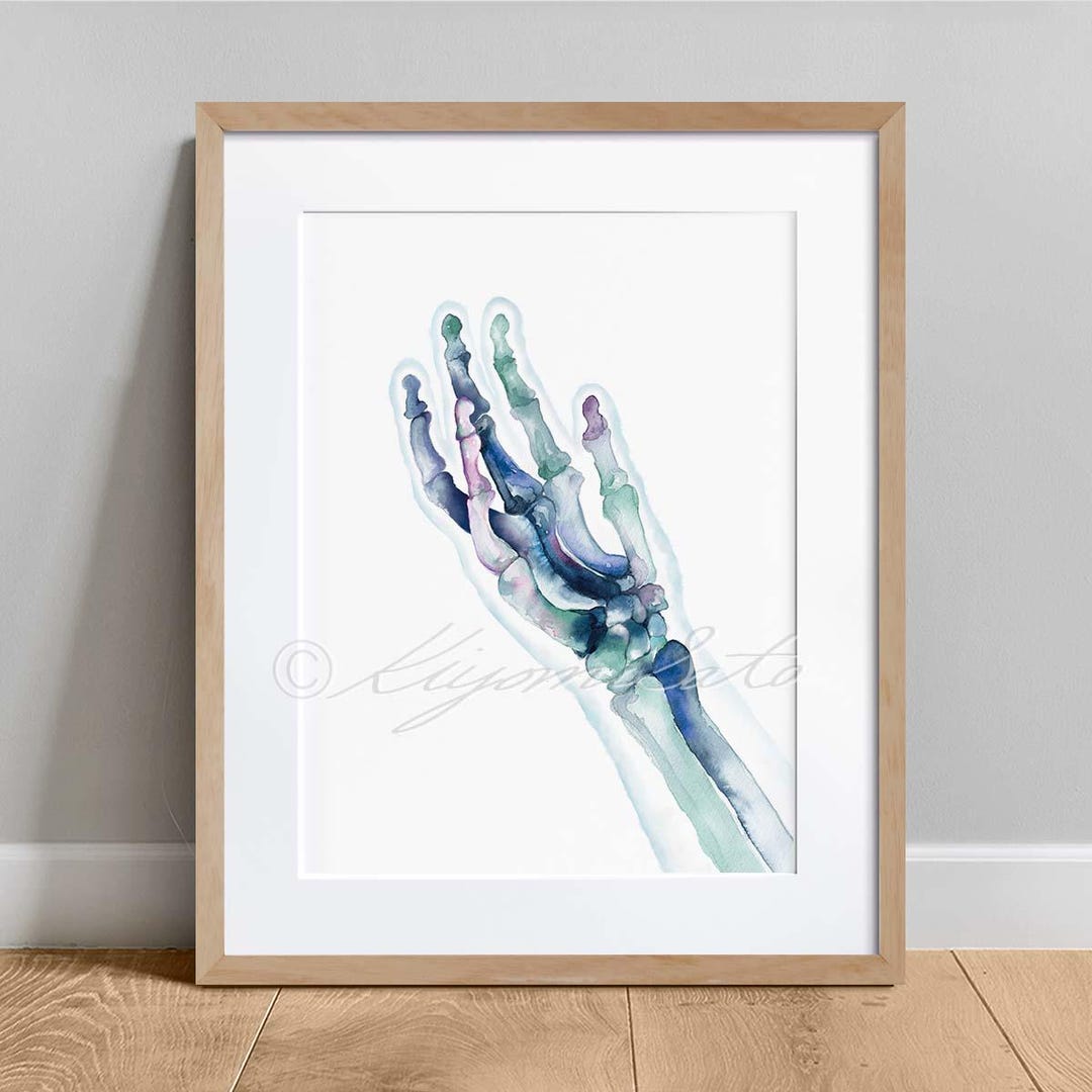 Watercolor Blue Hand Bones Art, Carpal Bones Occupational Therapy Decor ...