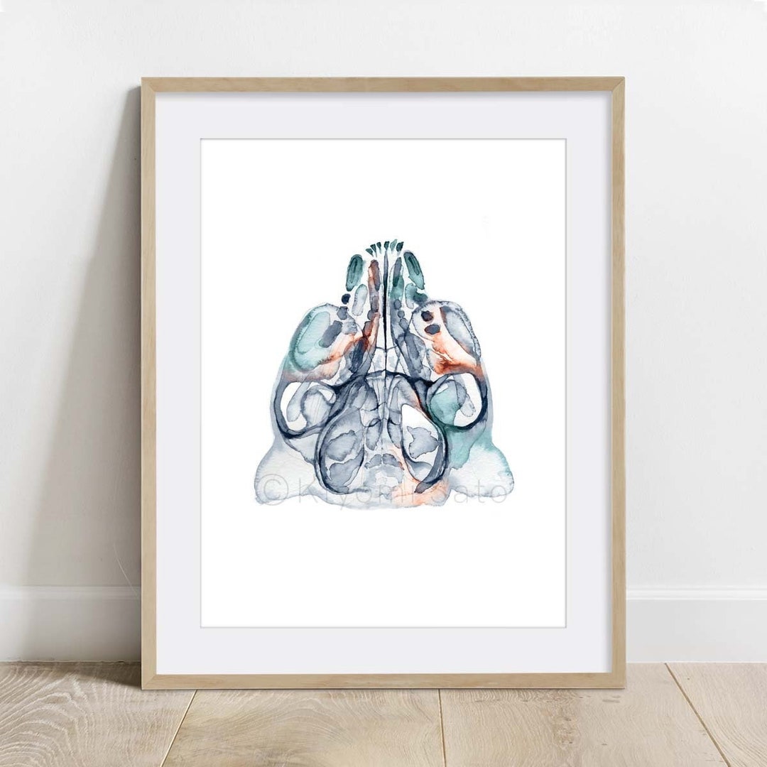 Feline Skull X Ray Art Poster, Veterinary Dental Print, Cat Bone X Ray ...