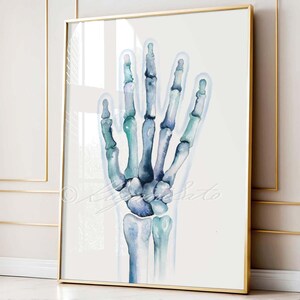 Abstract Art Hand Bones Posterior View, Occupational Therapy Decor ...