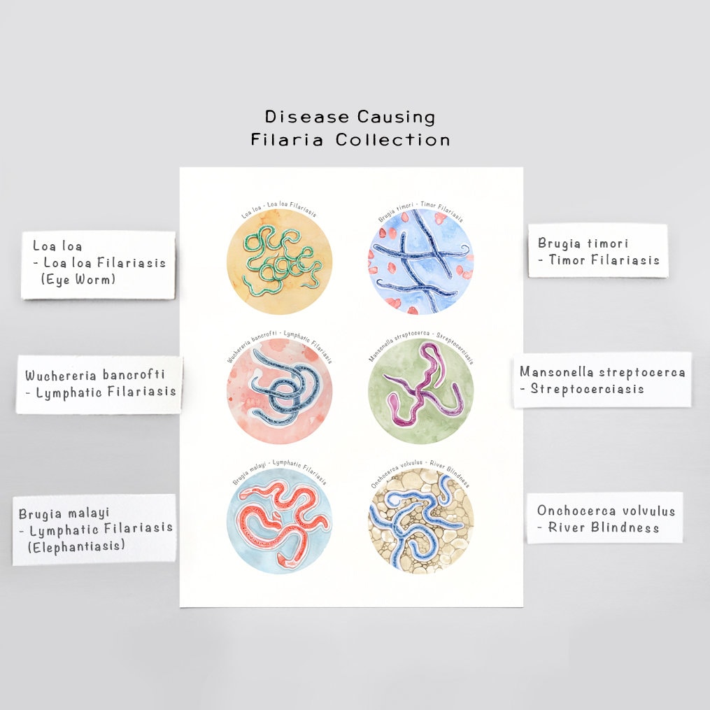 Disease Causing Filaria Collection, Parasite Science Art Print ...