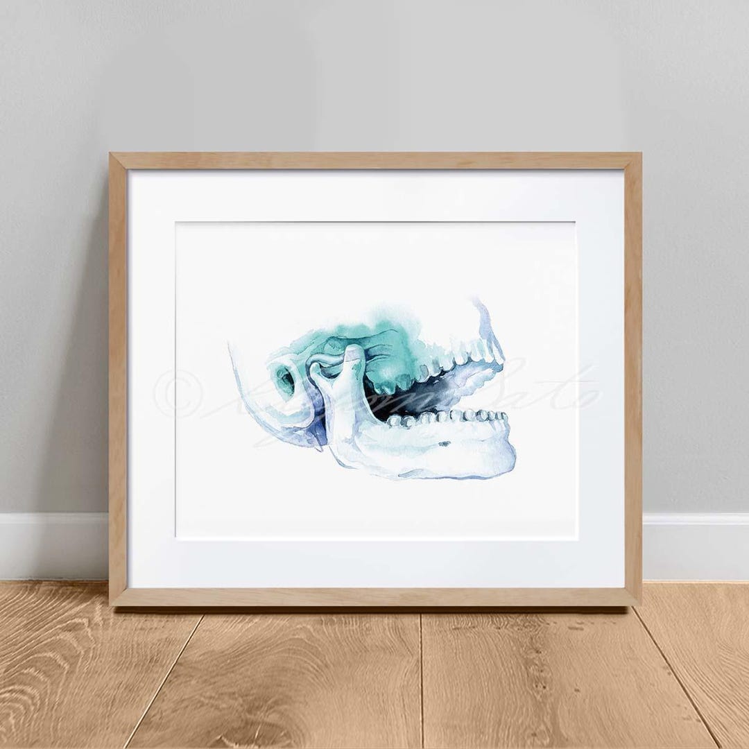 Open Jaw TMJ Art Print, Dental Office Decor, Watercolor Anatomy Poster ...