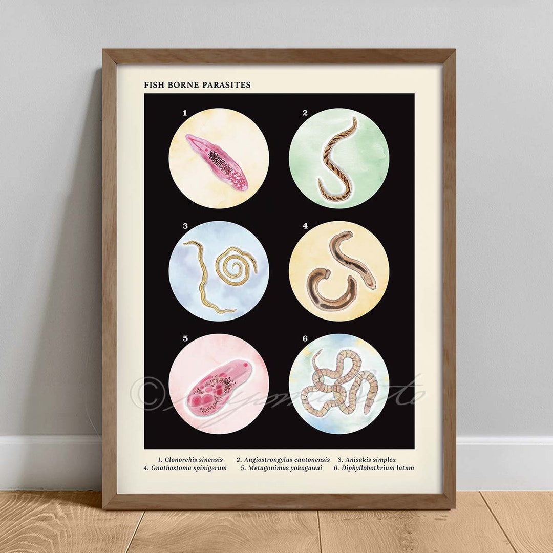 Fish Borne Parasites Collection Vintage Style Parasitology Art Poster ...