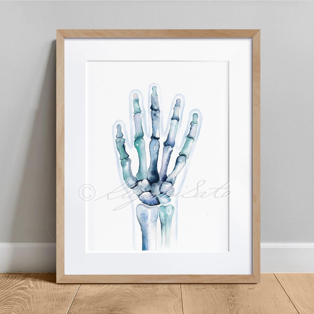 Abstract Art Hand Bones Posterior View, Occupational Therapy Decor ...