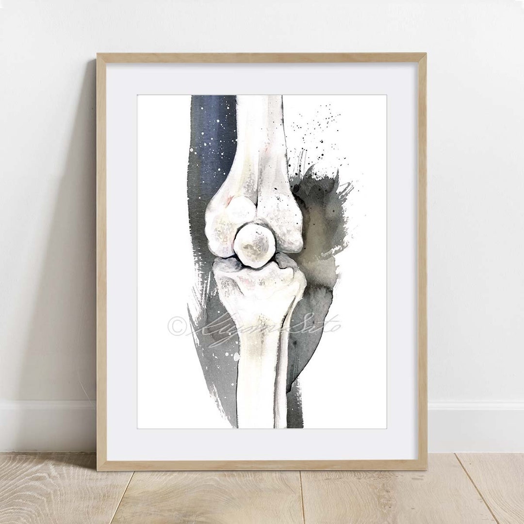 Knee Joint Abstract Art, Orthopedics Art Print, Science Art Poster ...