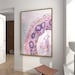 Appendix Histology Art, Watercolor Histology Art, Gastrointestinal ...