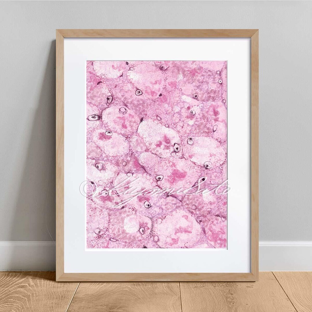 Mallory Body Histopathology Art Poster, Science Art Decor Poster - Etsy