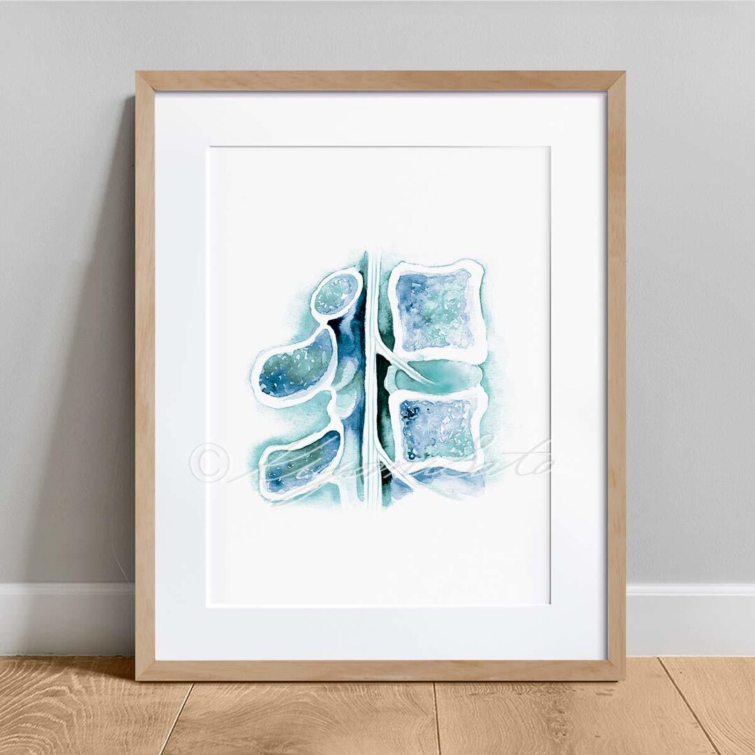 Spinal Disc and Nerve Abstract Art Poster, Orthopedics Wall Decor ...
