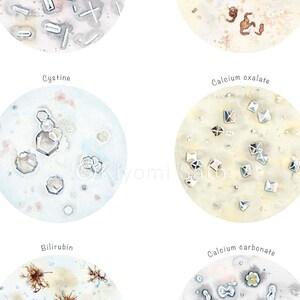 Crystals in Urine Collection Veterinary Art Print, Science Urology ...