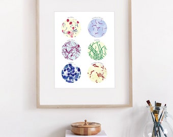 Giclée Pac-Man Toxin in Tuberculosis Canvas Acrylic Science Art Print ...