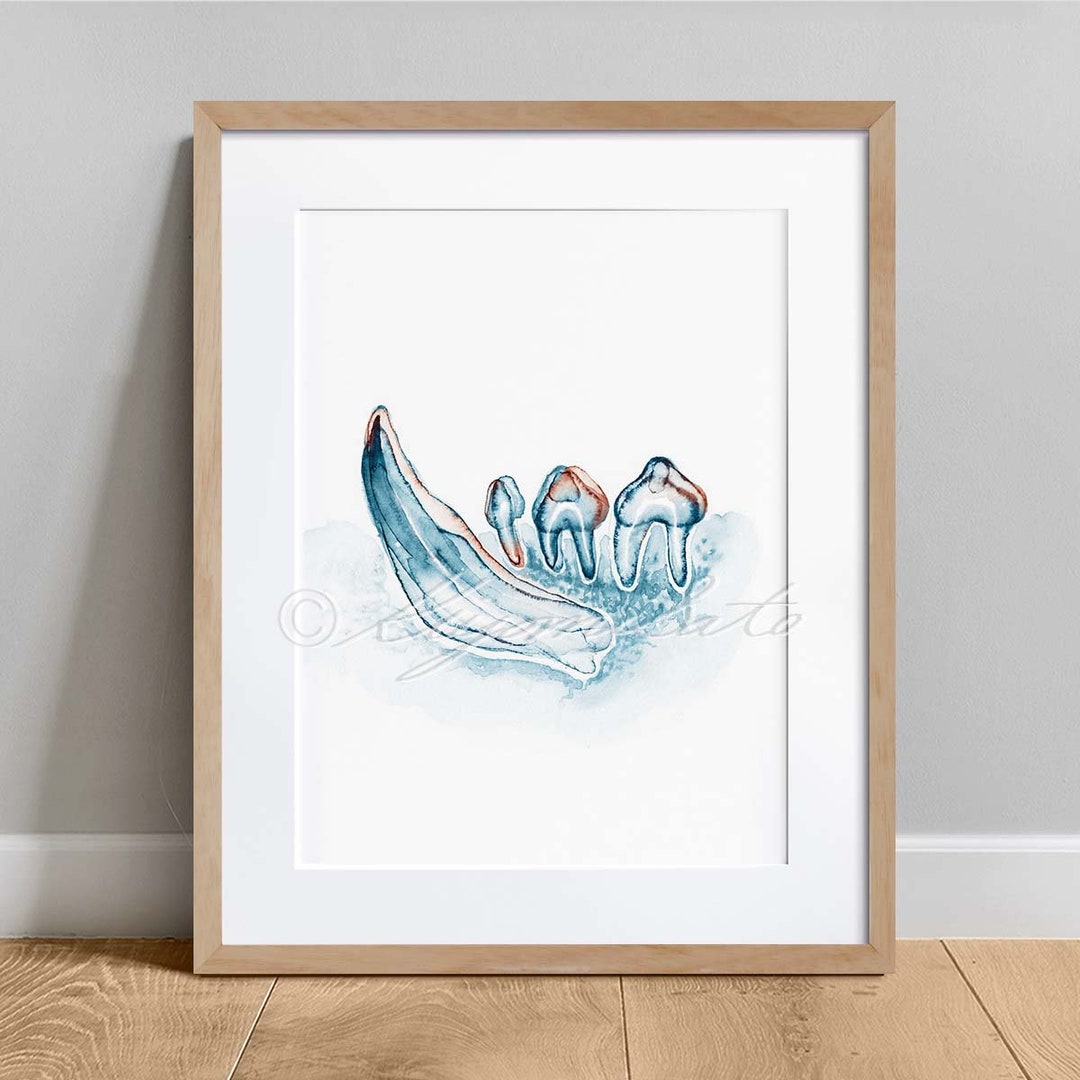 Endodontics Dentistry Art Tooth Poster, Vet Dental Print, Dog Cat Vet ...