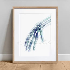 Hand Bones Blue Abstract Art, Carpal Bones Watercolor Art, Occupational ...