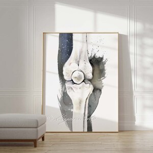 Knee Joint Abstract Art, Orthopedics Art Print, Science Art Poster ...