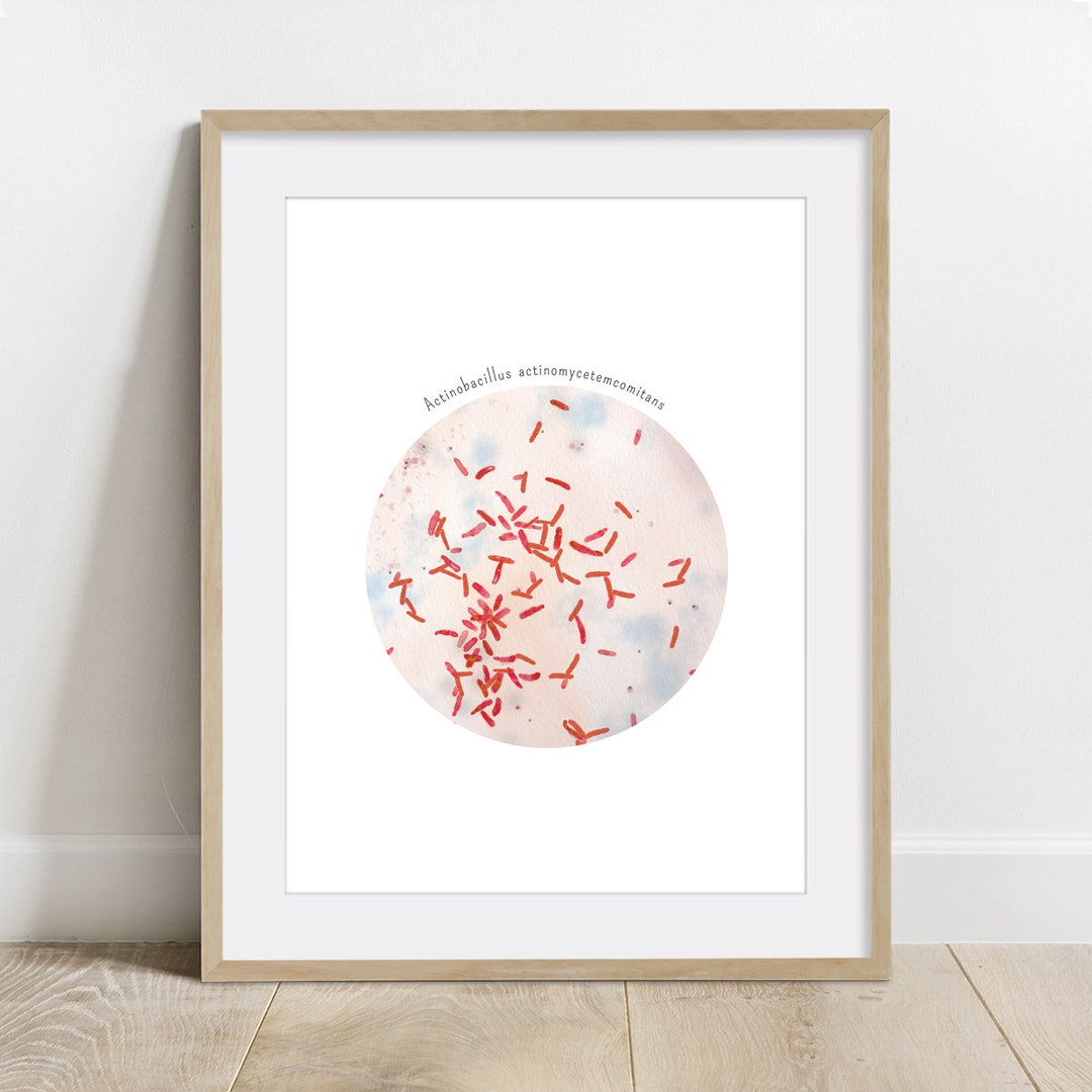 Actinobacillus Actinomycetemcomitans, Bacteria Art Print, Microbiology ...
