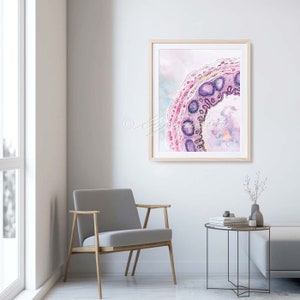 Appendix Histology Art, Watercolor Histology Art, Gastrointestinal ...