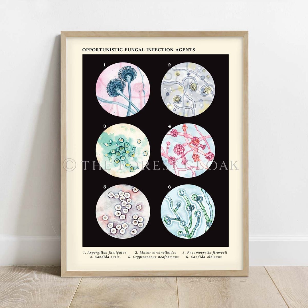 Opportunistic Fungal Infection Agents Collection Vintage Style Science ...