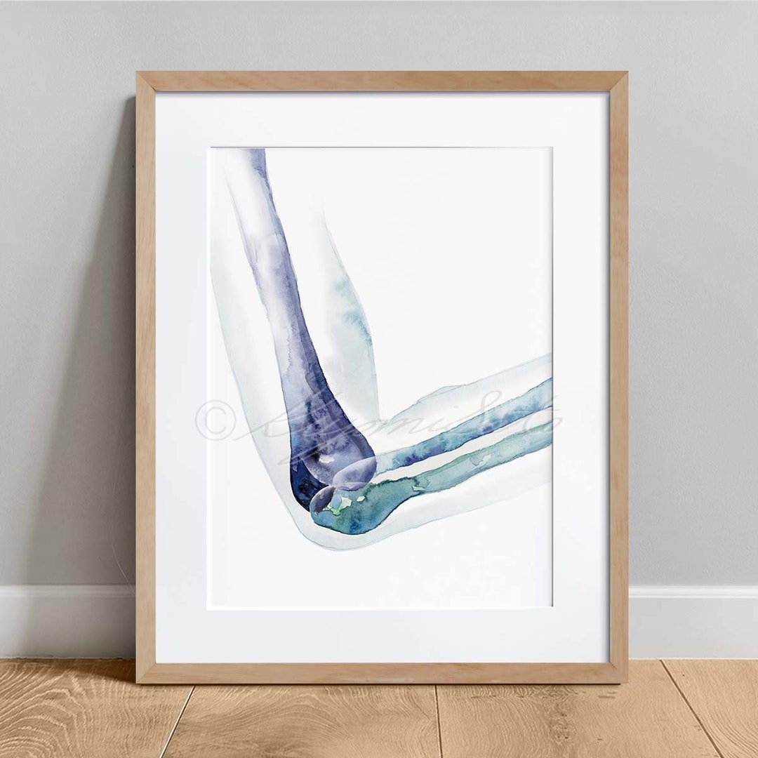 Elbow Bones Orthopedics Art Poster, Physical Therapy Art Poster ...