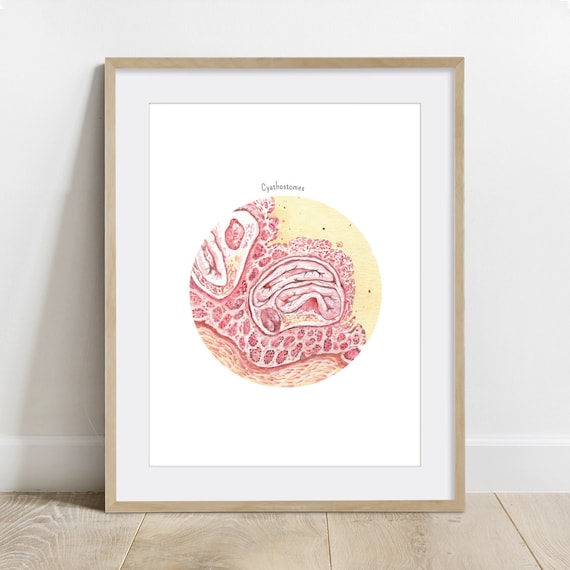 Cyathostomes Science Art Print Horse Parasite Poster | Etsy