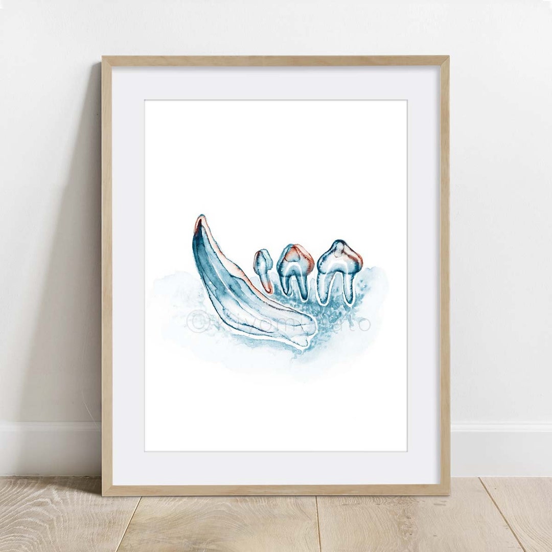 Endodontics Dentistry Art Tooth Poster Vet Dental Print Dog - Etsy