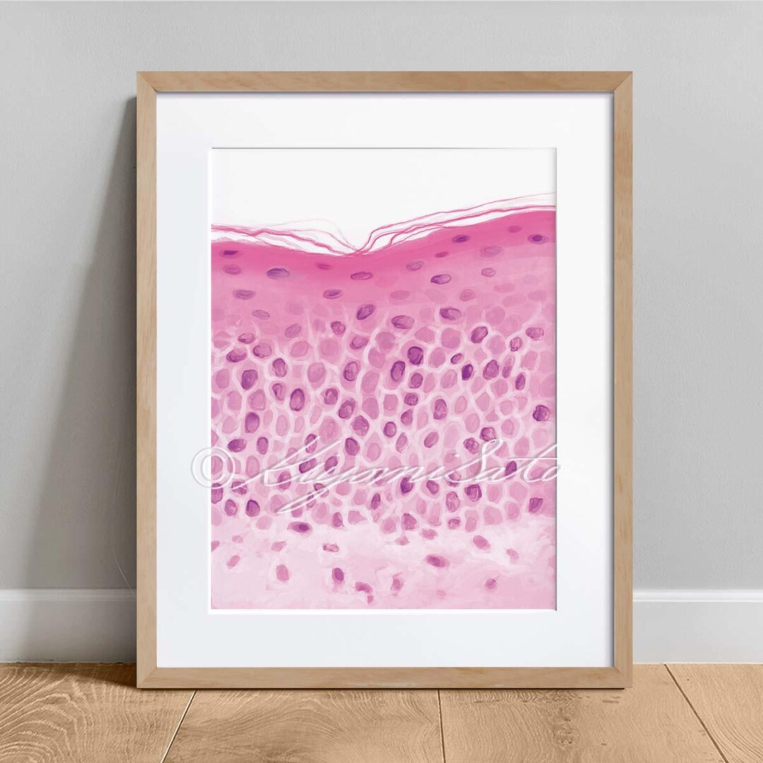 Parakeratosis Pathology Art Print, Dermatology Histology Wall Art ...