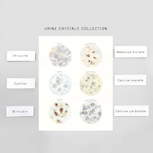 Crystals in Urine Collection Veterinary Art Print, Science Urology ...