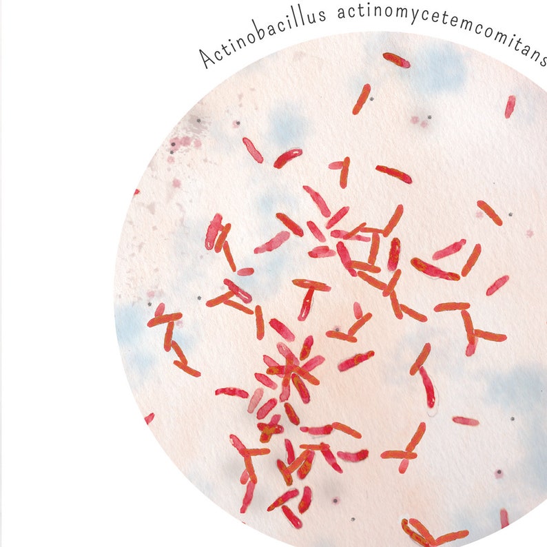 Actinobacillus Actinomycetemcomitans Bacteria Art Print - Etsy