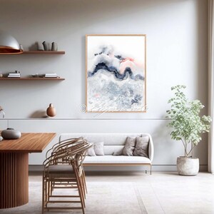 Healing Wounded Skin Histology Art Poster, Epidermis Histology ...