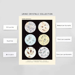 Crystals in Urine Collection Vintage Veterinary Art Print, Science ...