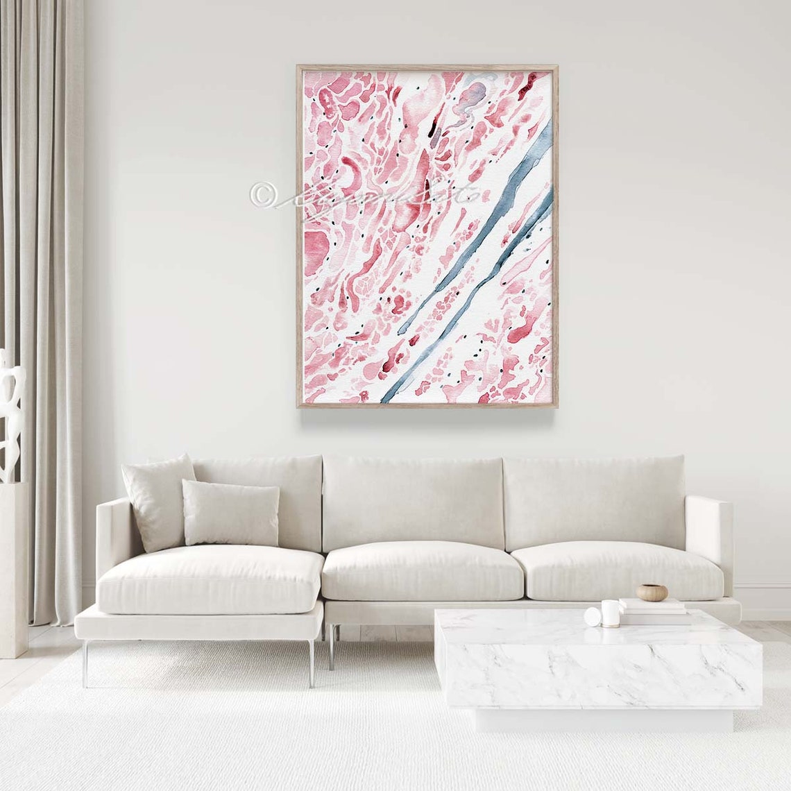 Connective Tissue Art Collagen Bundle Histology Art Science - Etsy