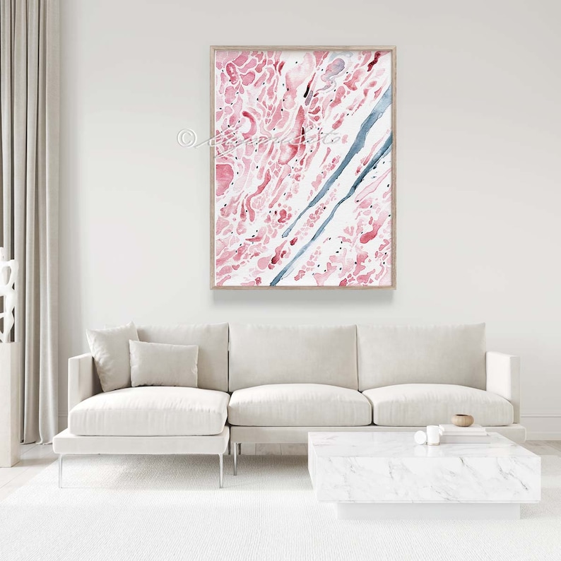 Connective Tissue Art Collagen Bundle Histology Art Science - Etsy