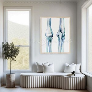 Elbow Joint Posterior and Anterior View, Abstract Art Print, Arm ...