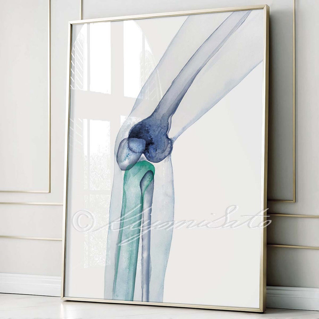 Knee Bones Orthopedics Abstract Art, Physical Therapy Art Poster ...