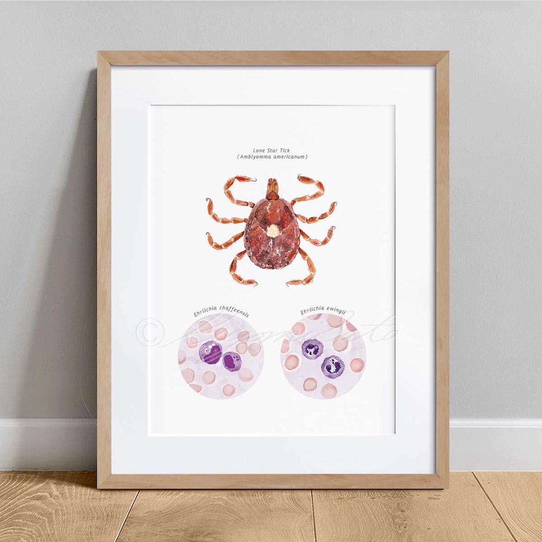 Lone Star Tick Vector Ehrlichiosis Illustration Poster, Parasitology ...