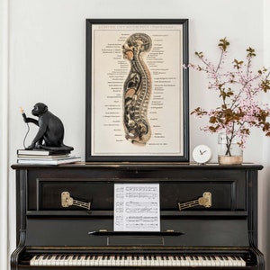 Vintage Human Body Print, Medical Wall Art, Surgical Art, Anatomy Wall ...