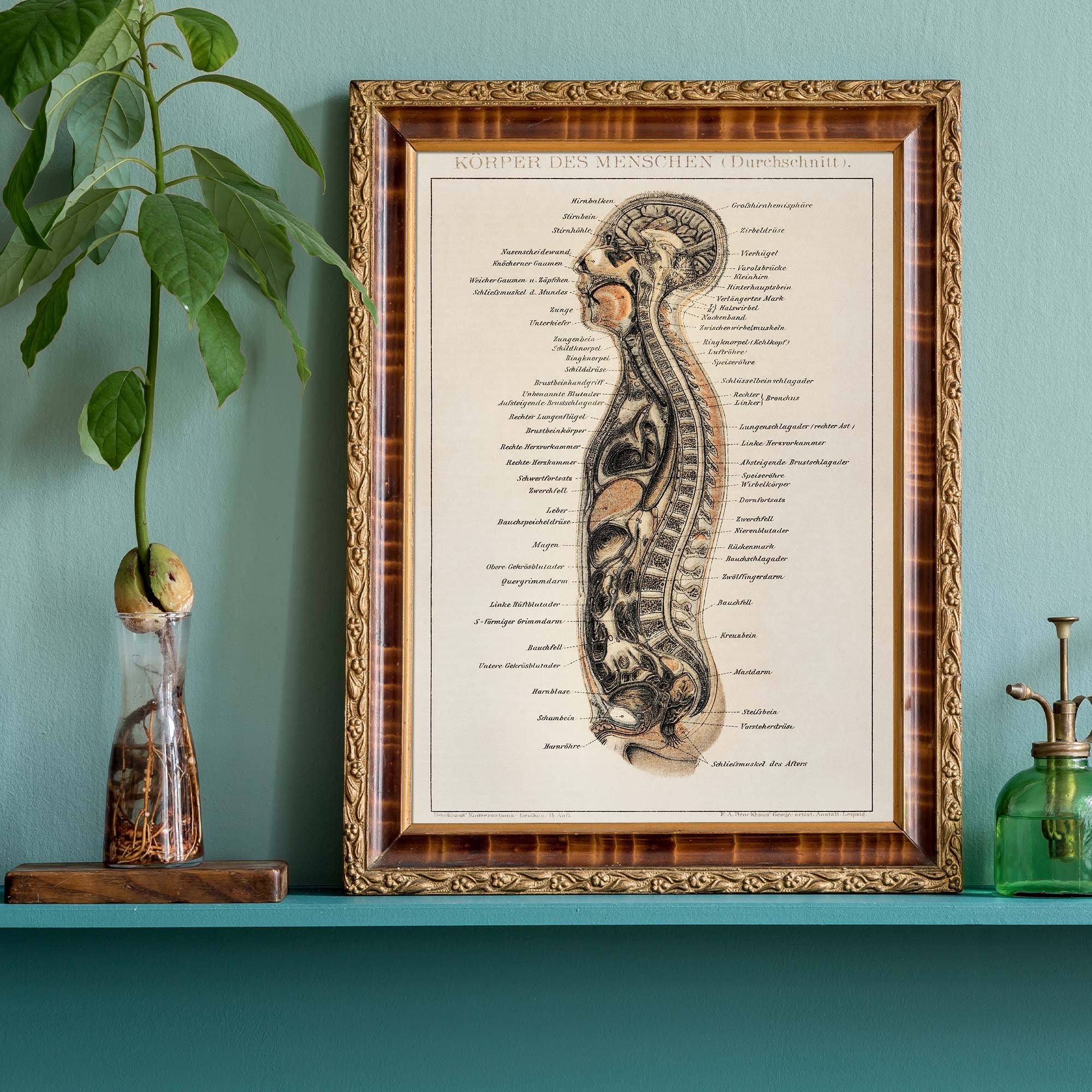 Vintage Human Body Print, Medical Wall Art, Surgical Art, Anatomy Wall ...