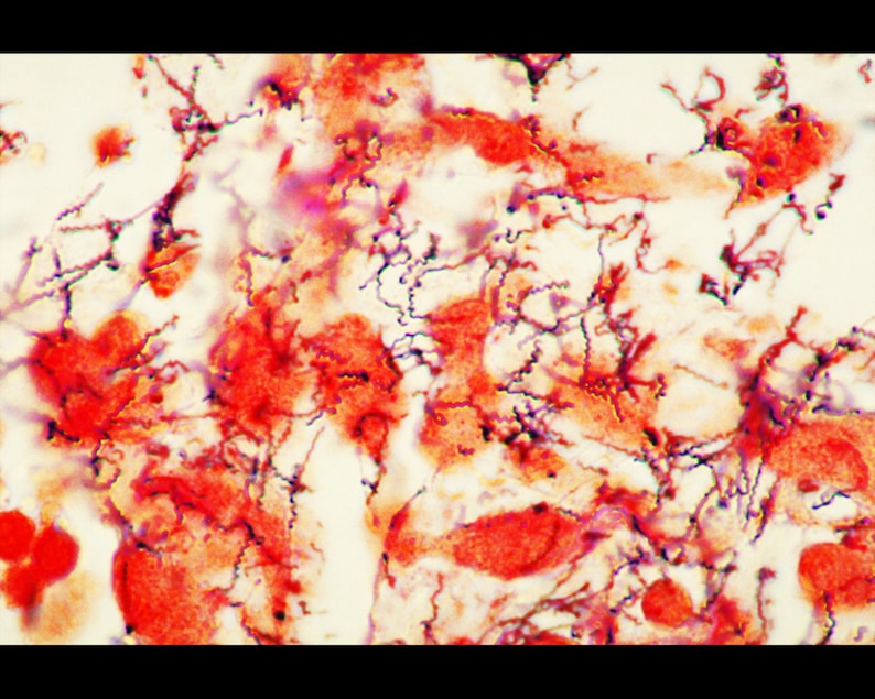 Science Art, Syphilis, STD, 8x10 Print, Unique Gift, Geek Art ...