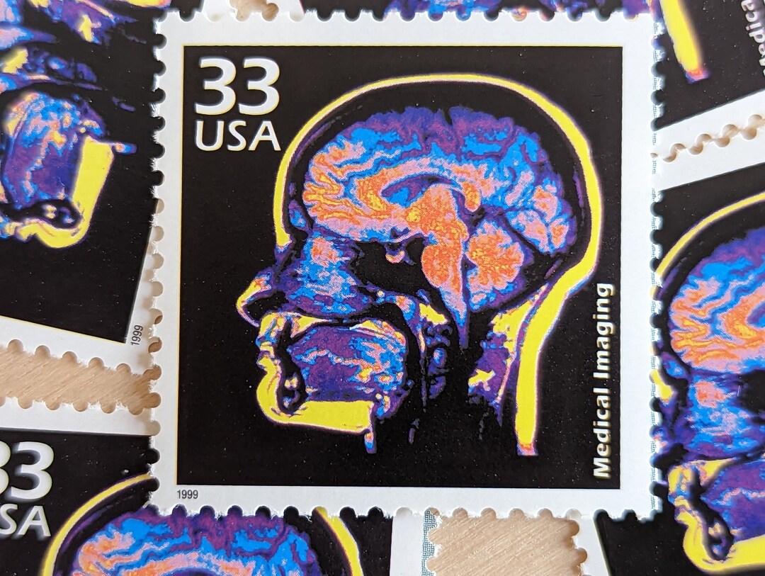 5 Medical Imaging Stamps, 33 Cent, 1998, 1970s Celebrate the Century ...