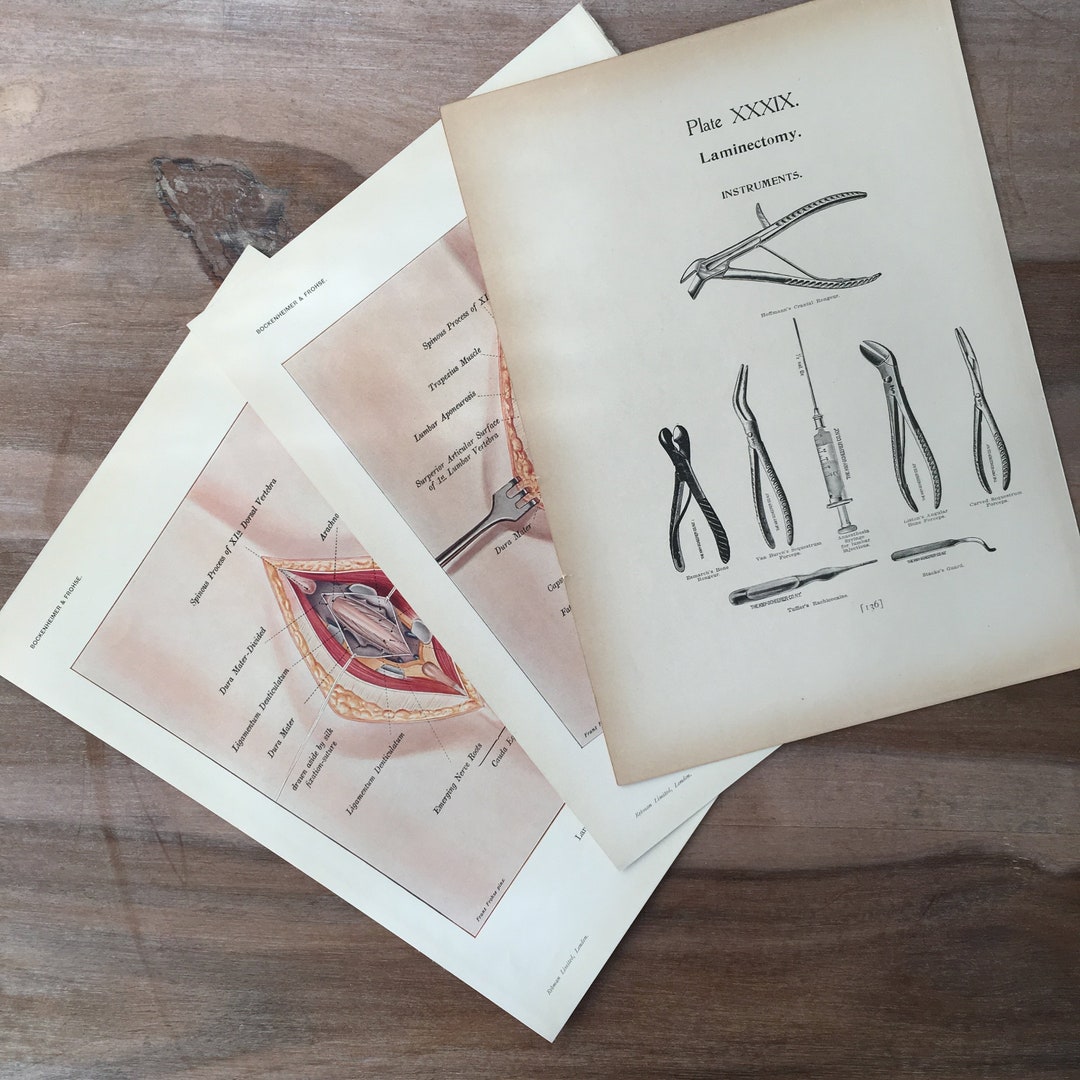 1906 Antique Medical Print Set of 3, Laminectomy Print, Anatomy Art ...