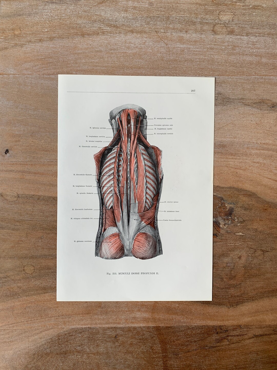 1962 Vintage Human Anatomy, Anatomy Print - Back Muscles, Myologia ...