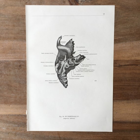 Home & Living temporal bone Osteology Print 1962 Vintage Medical Print ...