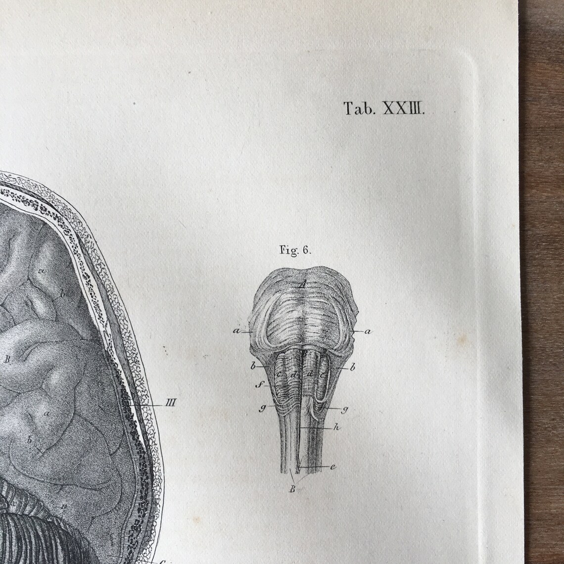 1871 Rare Medical Engraving Human Brain Structure Brain - Etsy