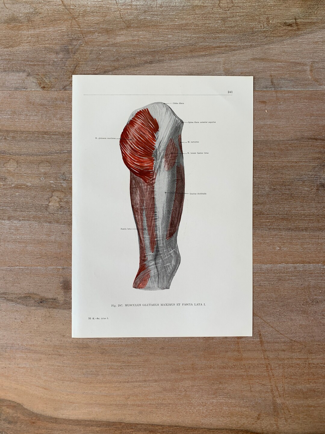 1962 Vintage Medical Print, Hip Leg Muscles, Human Leg Structure ...