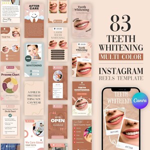 Teeth Whitening Instagram Reels Template, Dental Reels Template, Reels ...
