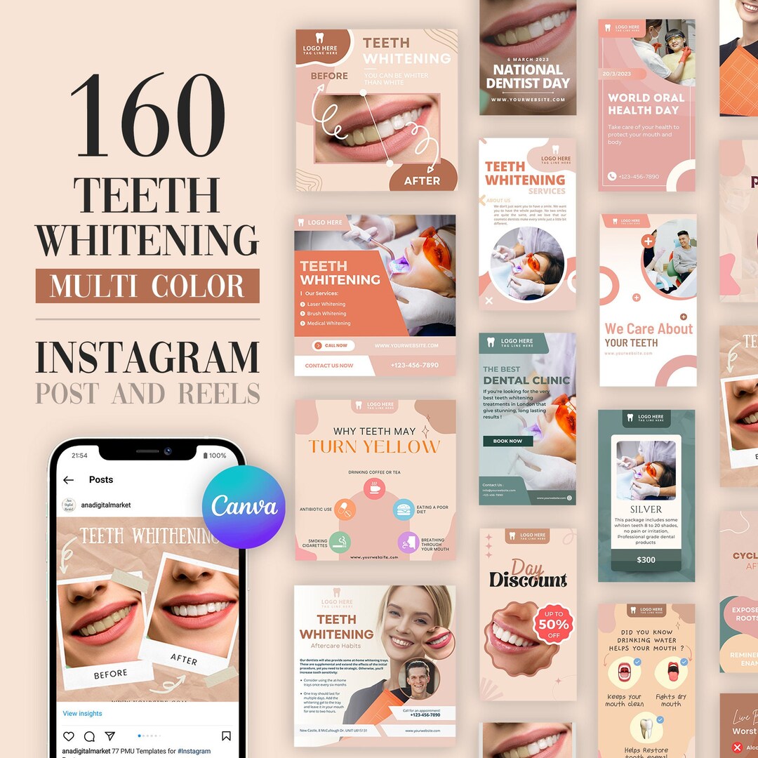 160 Teeth Whitening, Instagram Post and Reels, Social Media Templates ...