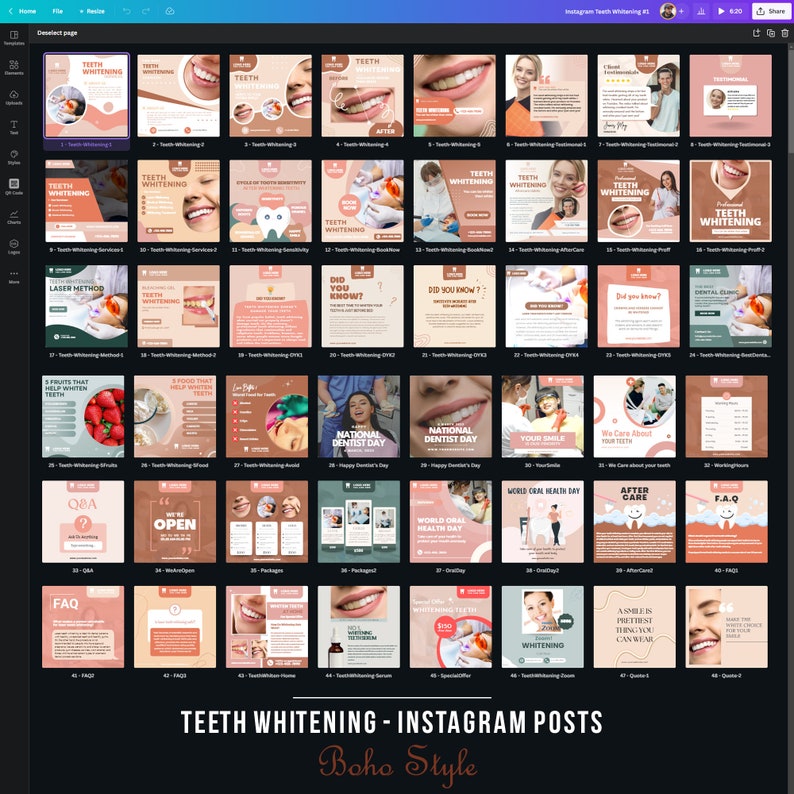 160 Teeth Whitening, Instagram Post and Reels, Social Media Templates ...