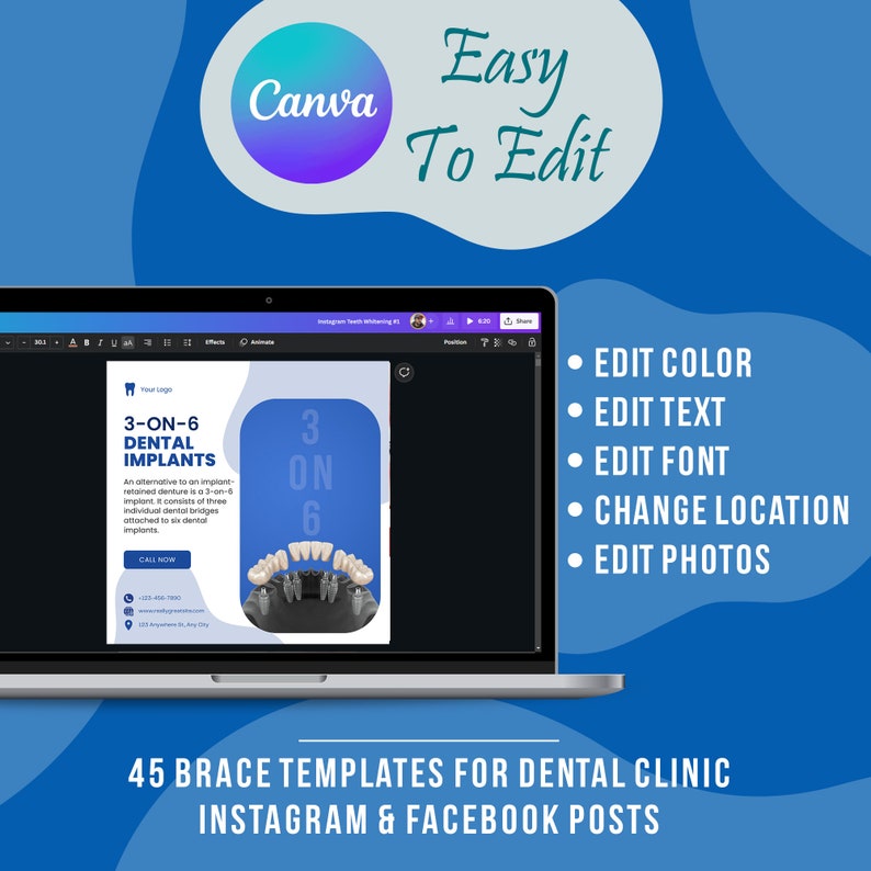 Dental Implant Instagram Post Template Editable Template for - Etsy