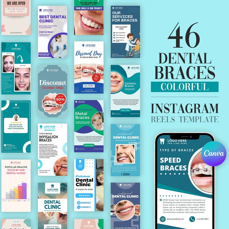 46 Dental Braces Instagram Reels Template, Editable Template, Dental ...